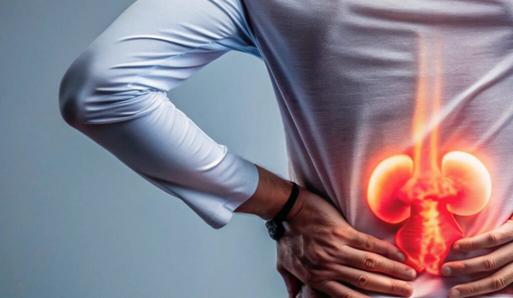 O que fazer durante um episódio de cólica renal? | Cá Entre Nós